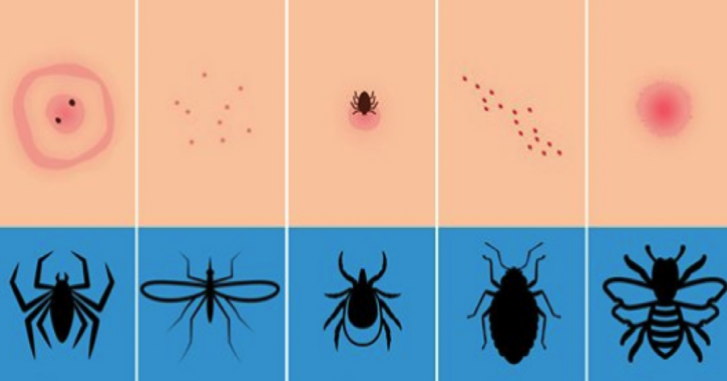 Dziesięć ukąszeń owadów: Co można zrobić – Lepiej tego nie lekceważyć ...